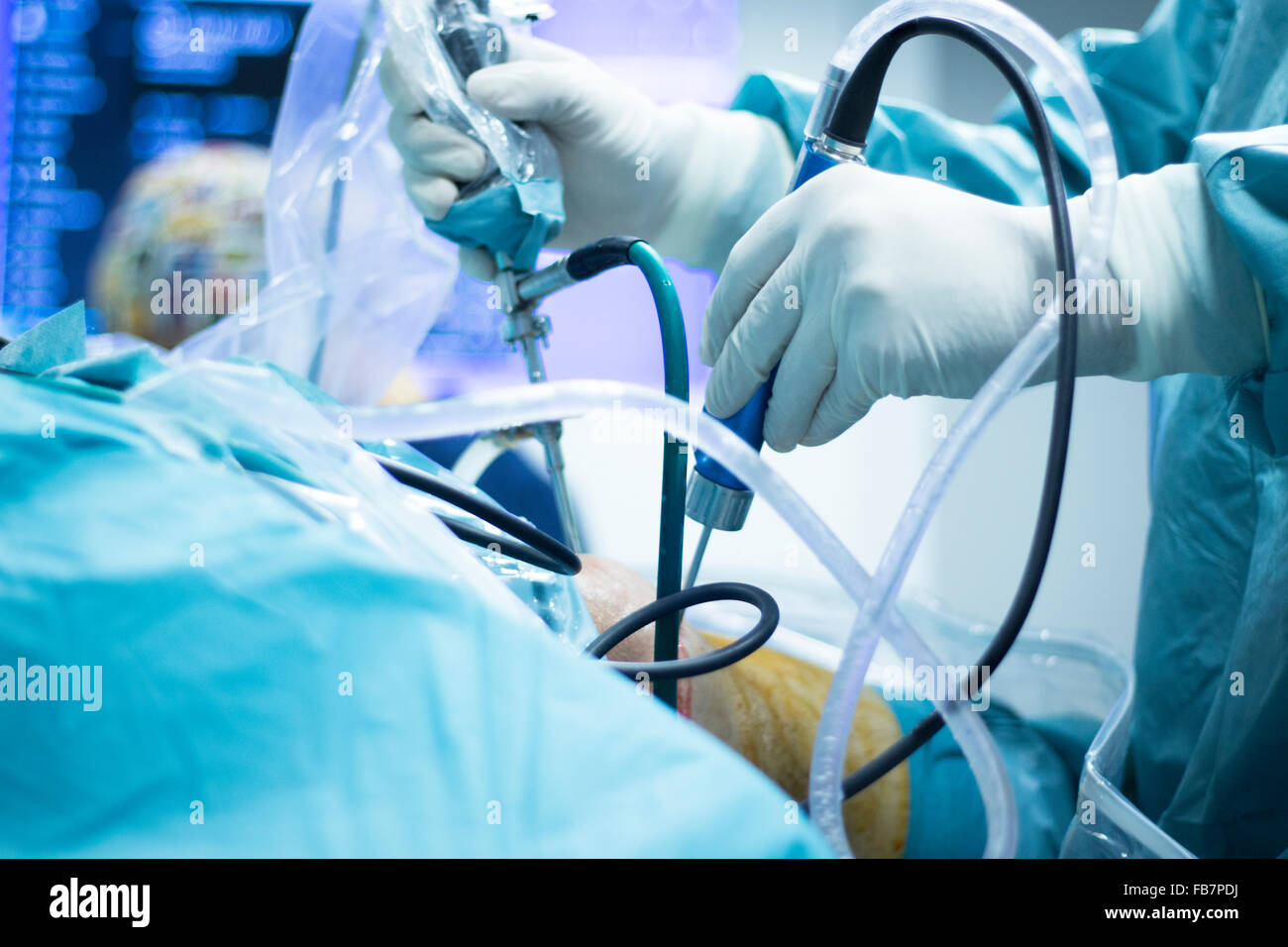 Knee arthroscopy orthopedic surgery operation in hospital operating ...