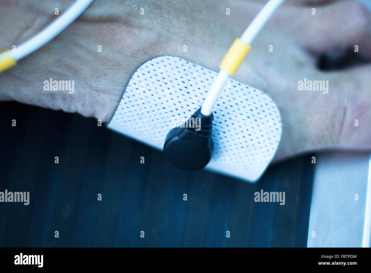 Physiotherapy and orthopedics clinic patient in electrical impulse ...