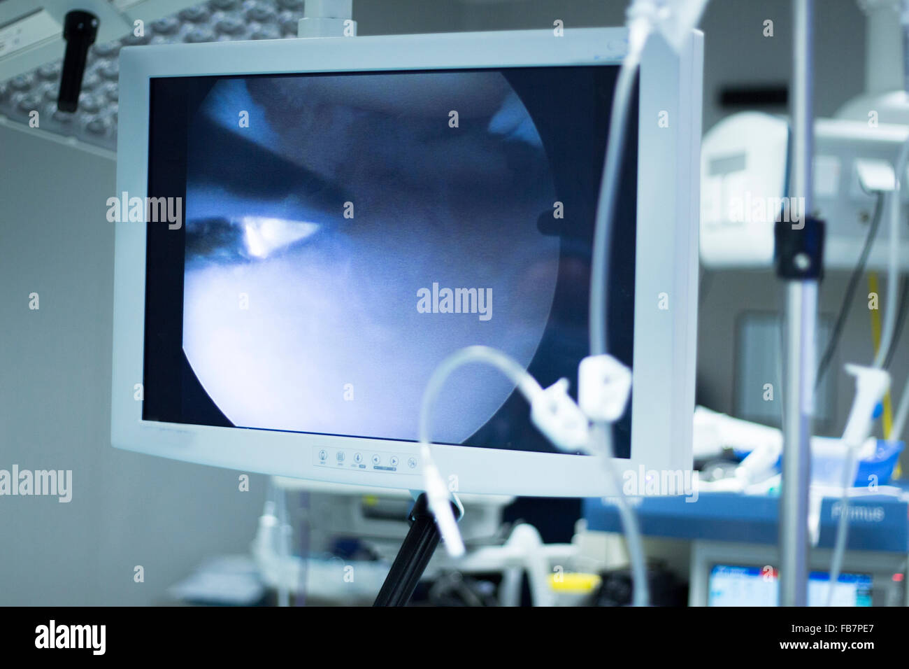 Hospital keyhole micro surgery arthroscopy operation screen showing ...