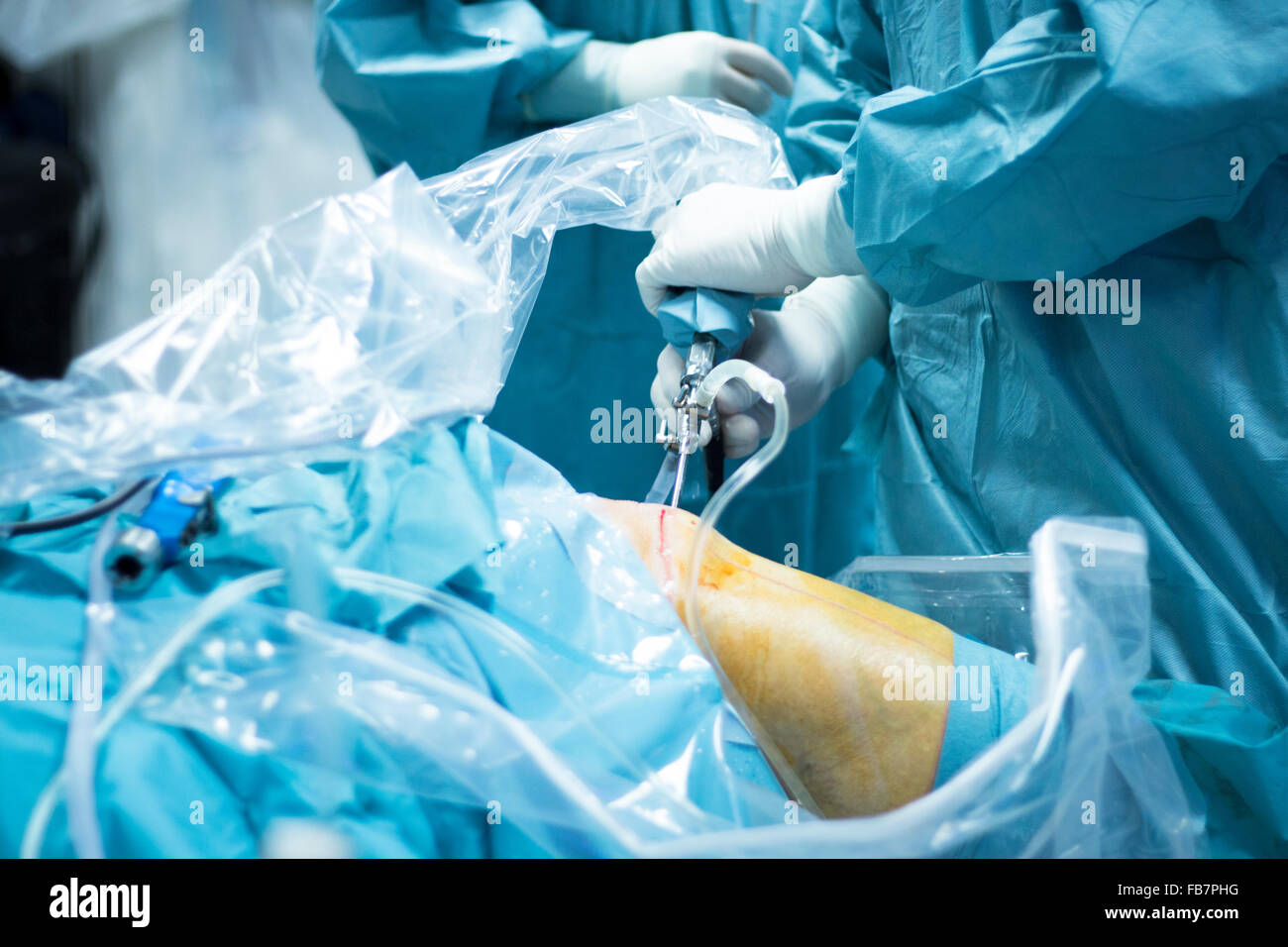 Knee arthroscopy orthopedic surgery operation in hospital operating ...