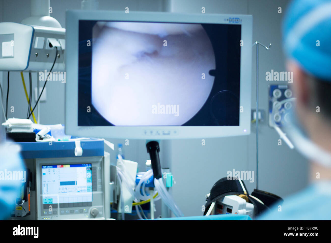 Hospital keyhole micro surgery arthroscopy operation screen showing ...