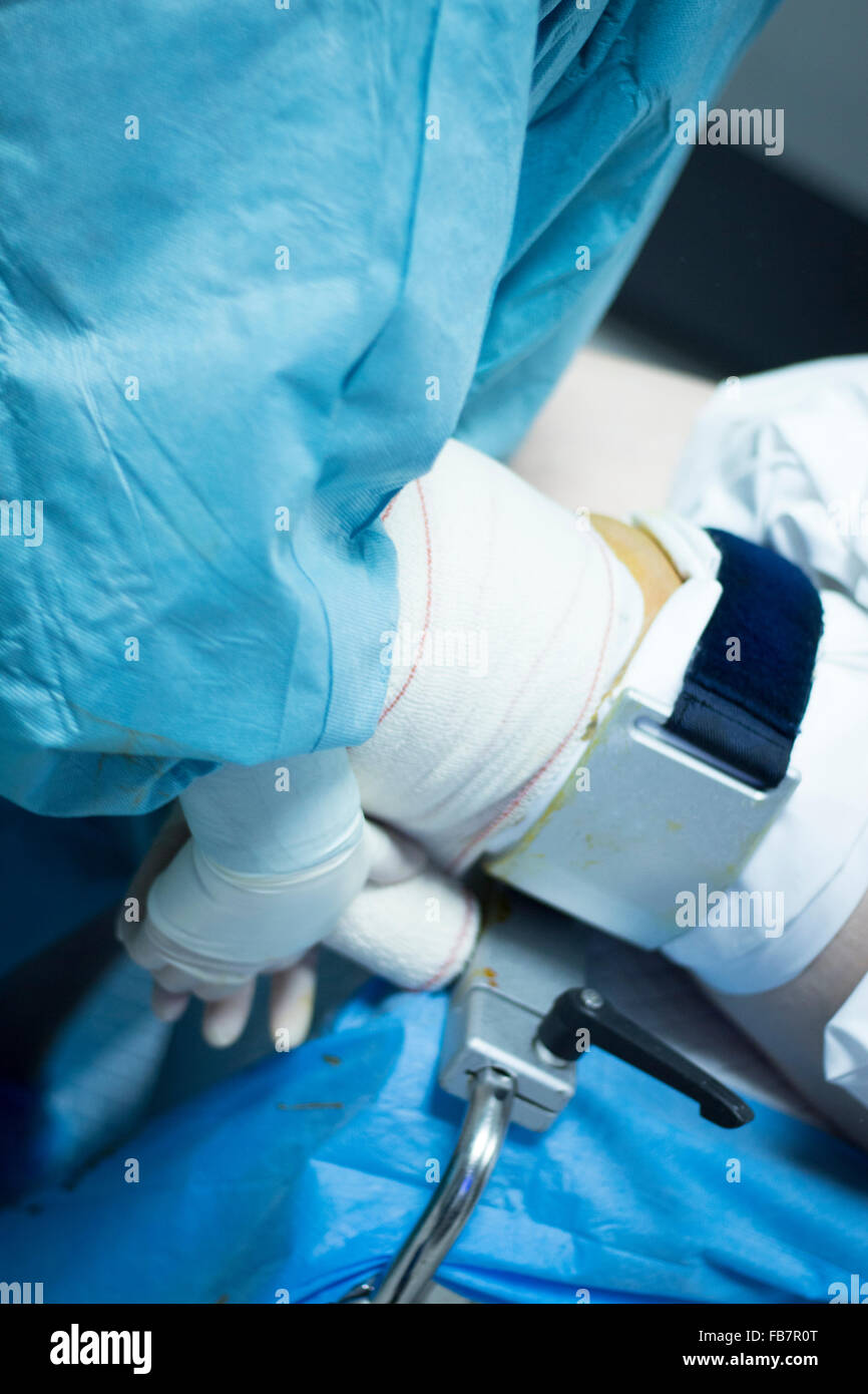 Knee arthroscopy orthopedic surgery operation in hospital emergency ...