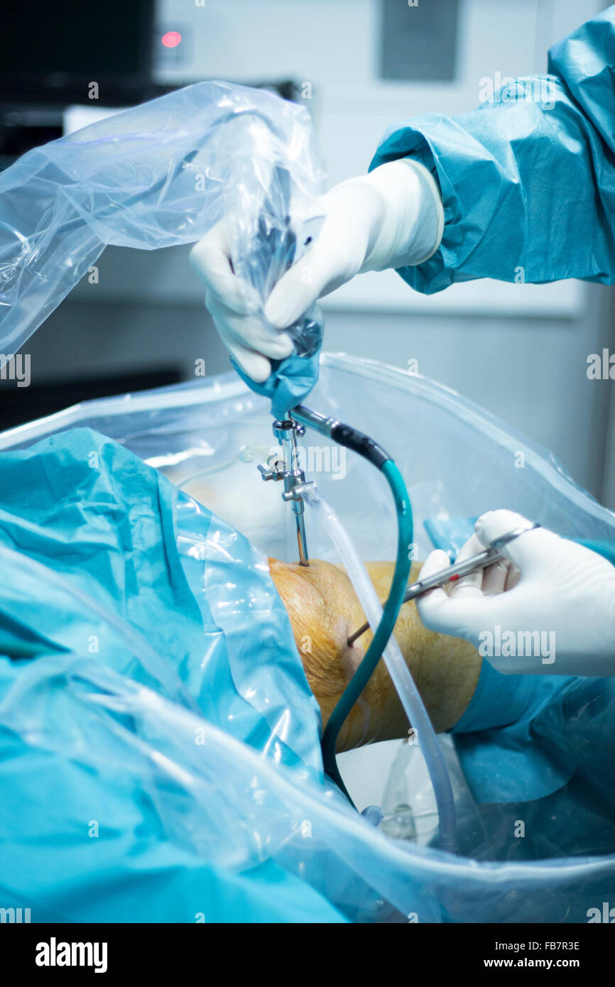 Knee arthroscopy orthopedic surgery operation in hospital emergency ...