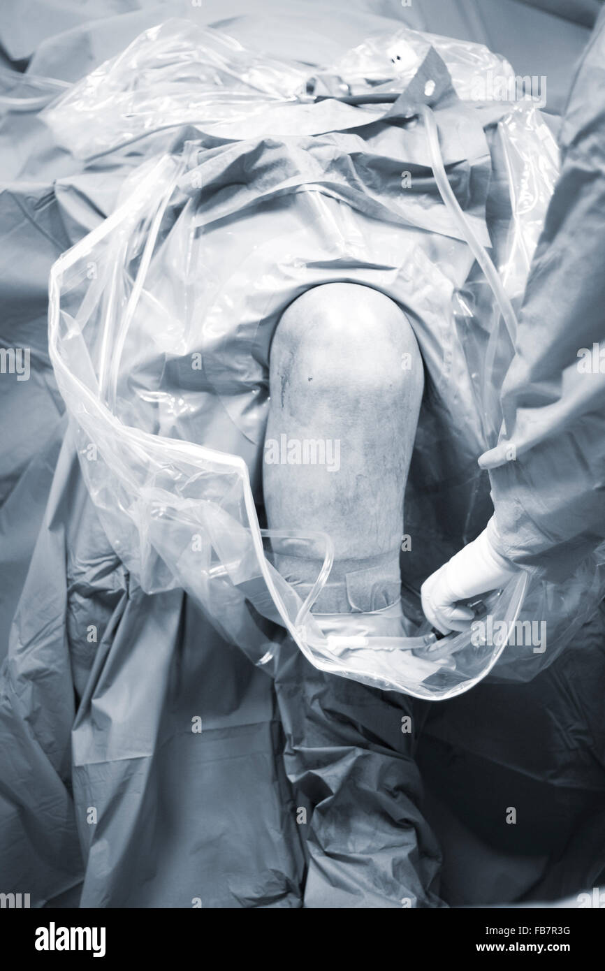 Knee arthroscopy orthopedic surgery operation in hospital emergency ...