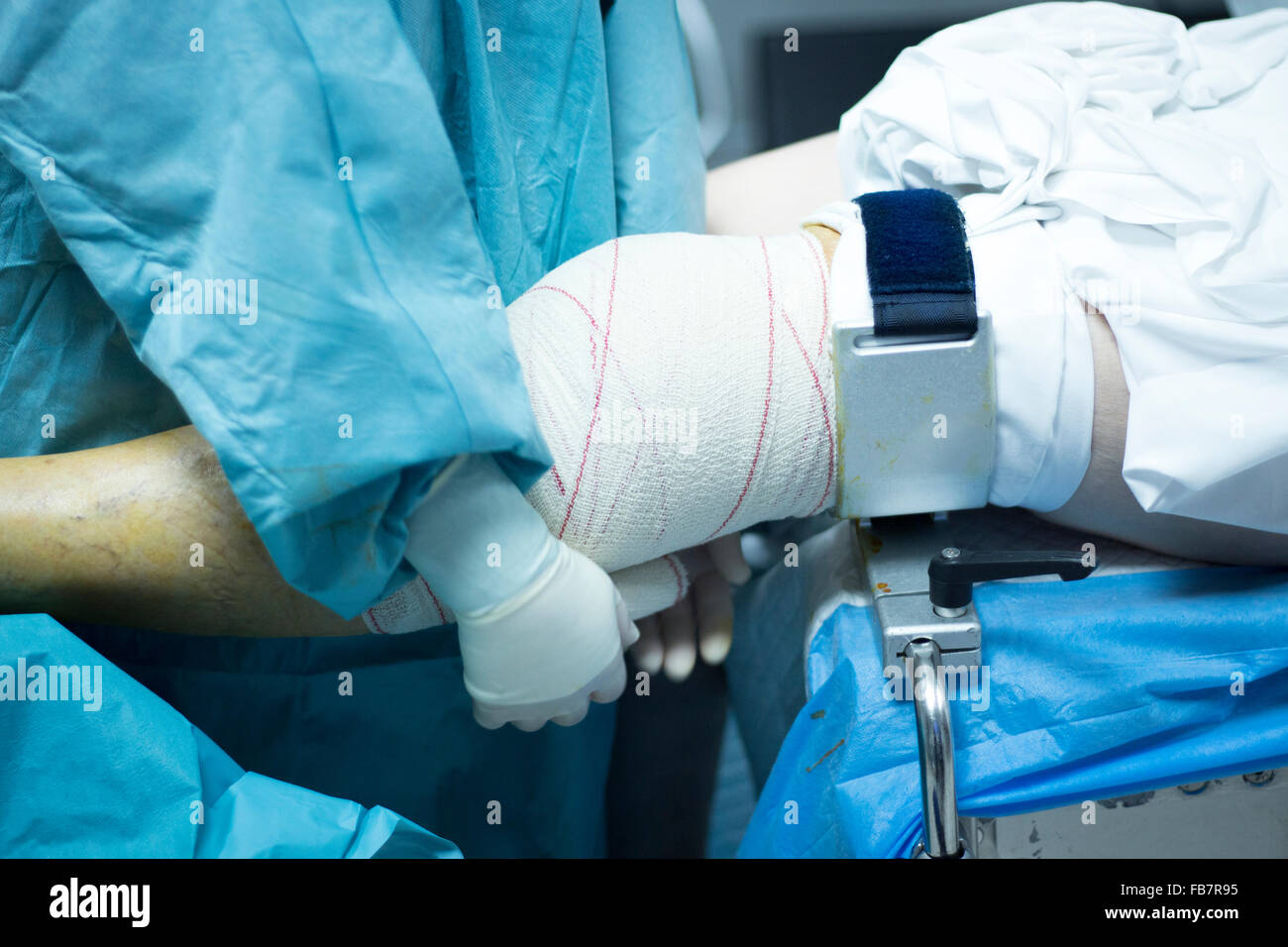 Knee arthroscopy orthopedic surgery operation in hospital emergency ...