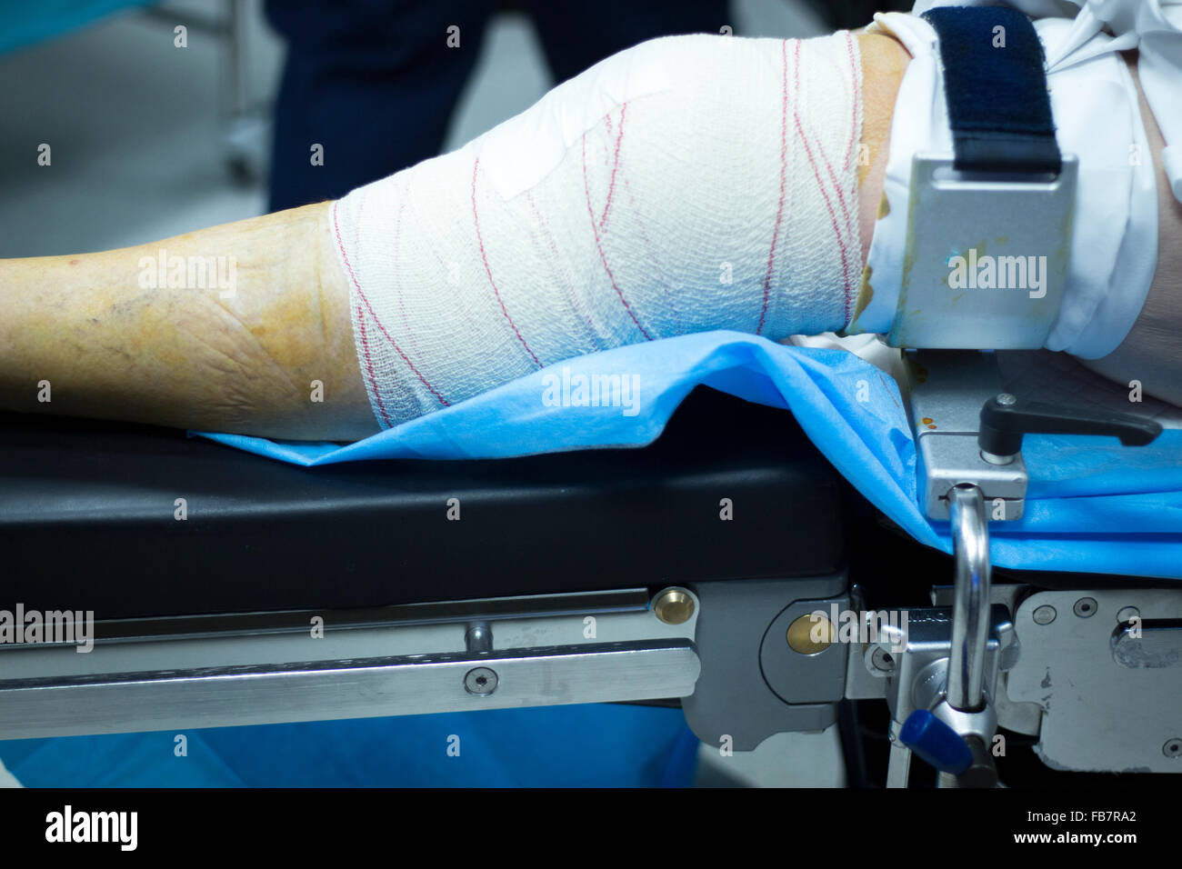 Knee arthroscopy orthopedic surgery operation in hospital emergency ...