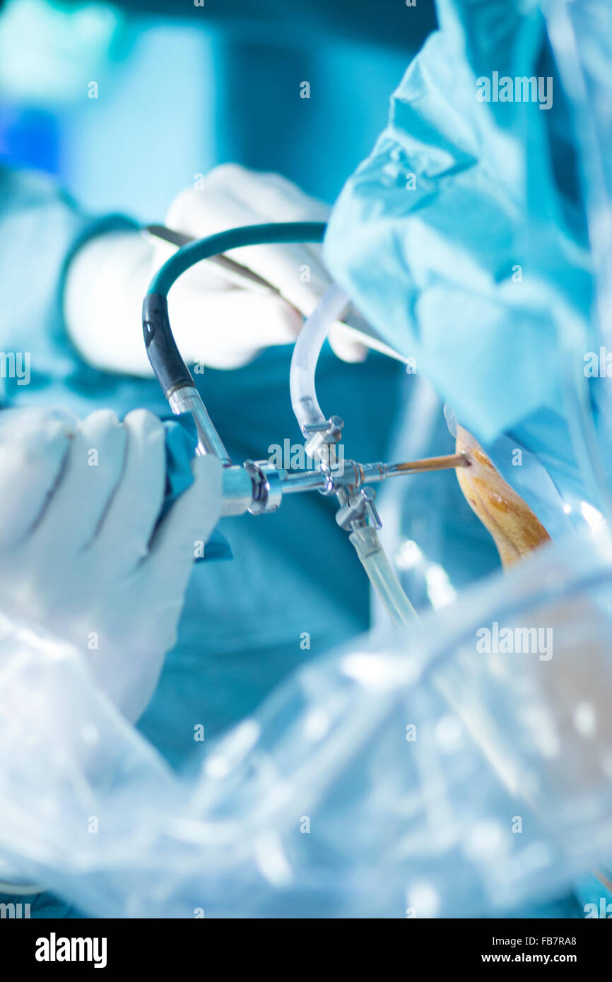 Hospital orthopedics Traumatology surgical operation on torn meniscus ...