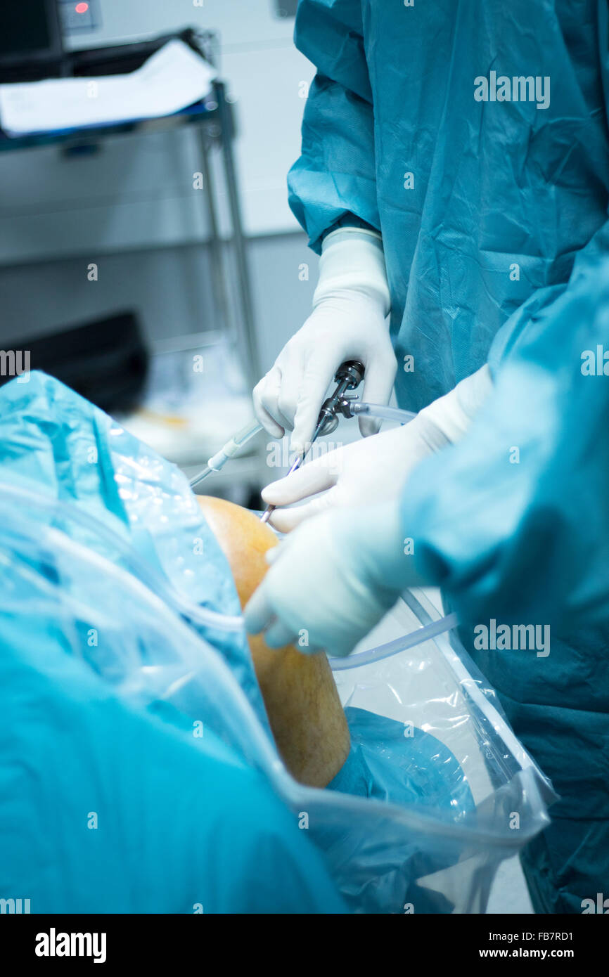 Knee arthroscopy orthopedic surgery operation in hospital emergency ...