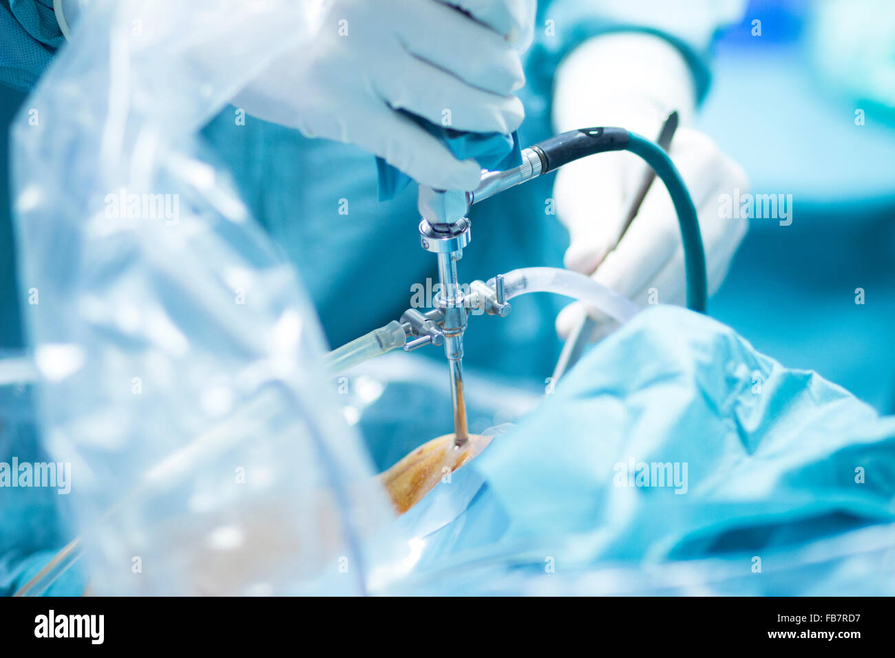 Hospital orthopedics Traumatology surgical operation on torn meniscus ...