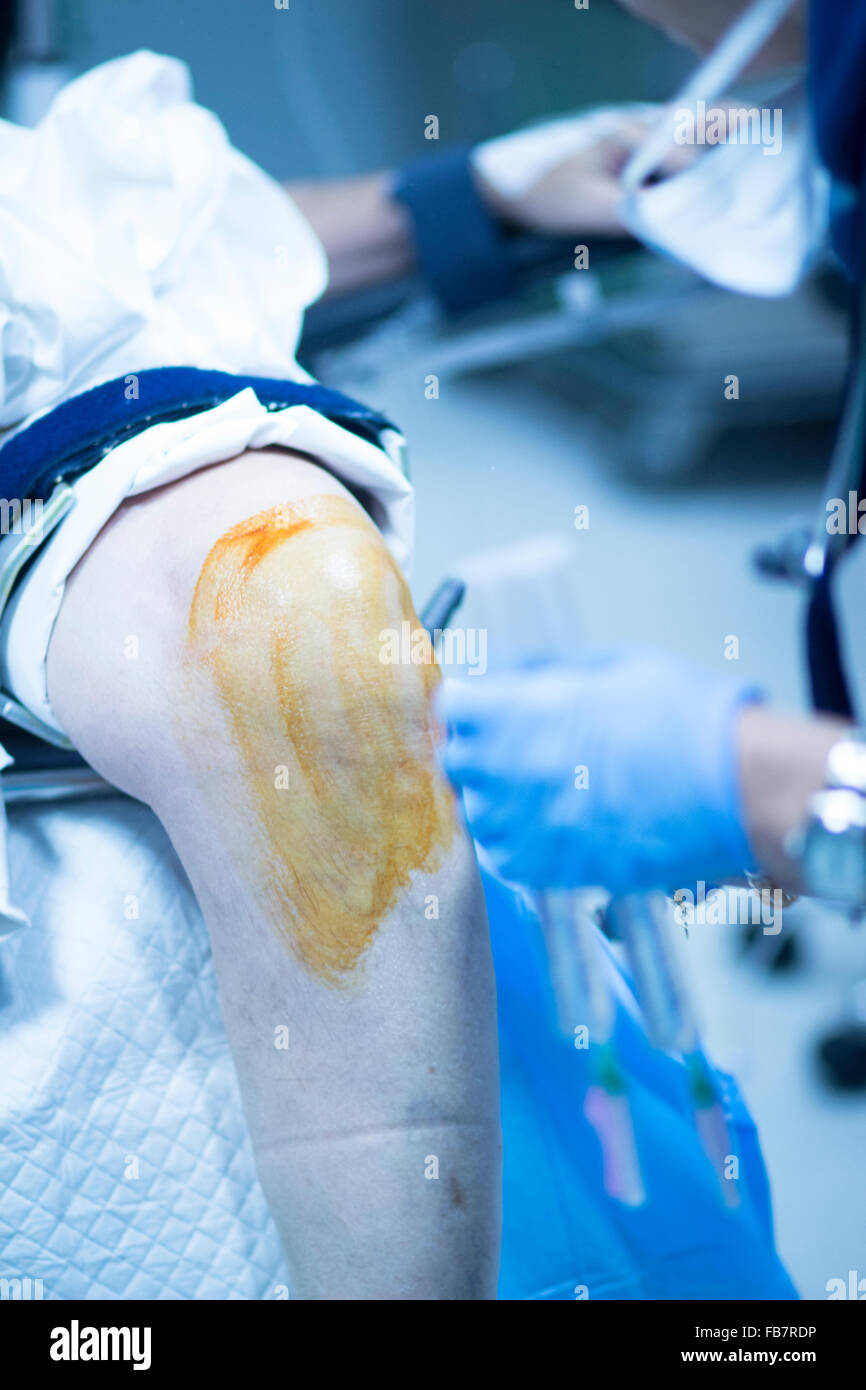 Hospital orthopedics Traumatology surgical operation on torn meniscus ...
