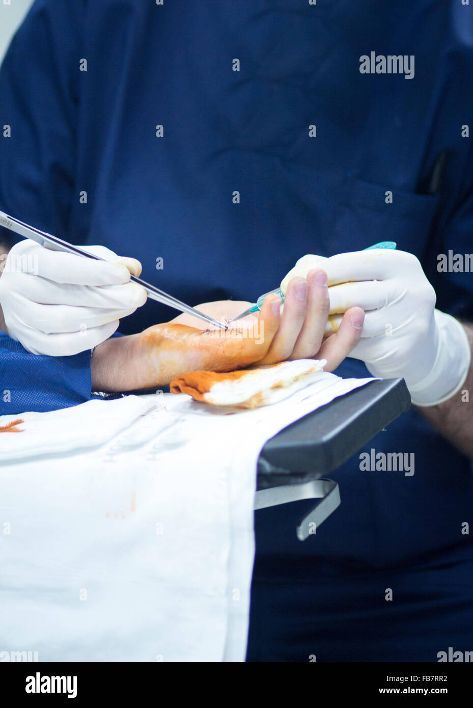 Hospital hand surgery orthopedics operation photo Stock Photo - Alamy