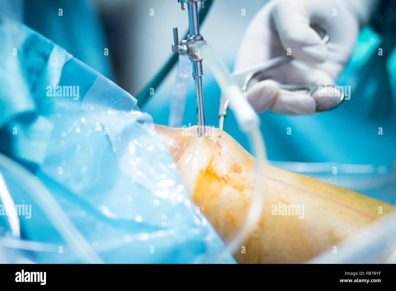 Orthopedics knee surgery Traumatology hospital surgical operation photo ...