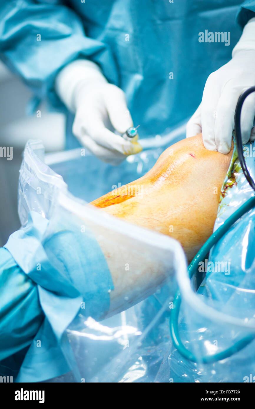 Orthopedic surgery meniscus operation hospital emergency operating room ...