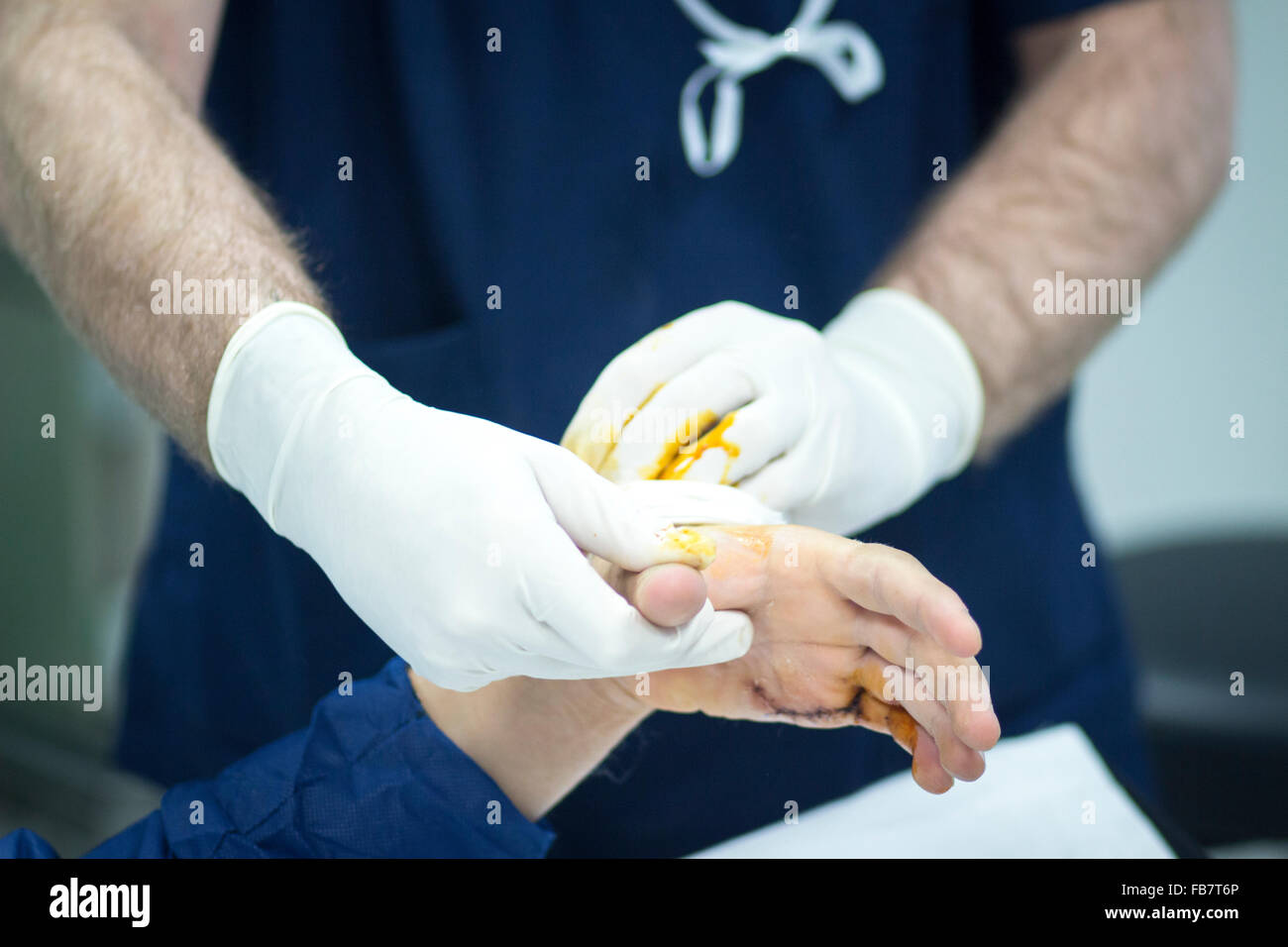 Hospital hand surgery orthopedics operation photo Stock Photo - Alamy