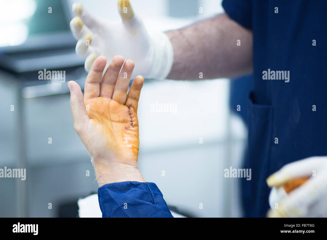 Hospital hand surgery orthopedics operation photo Stock Photo - Alamy