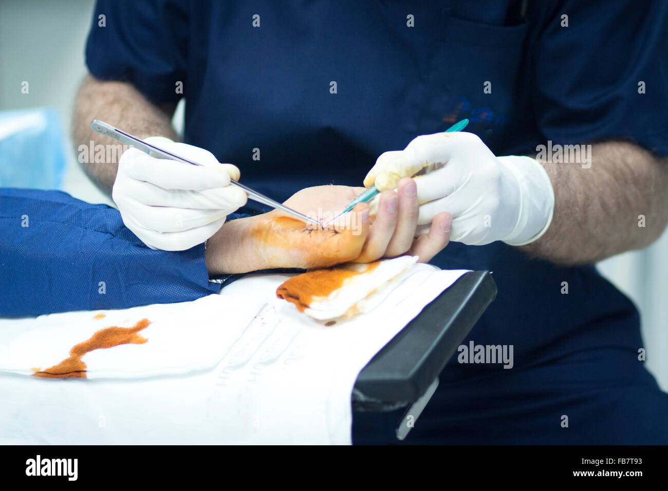 Hospital hand surgery orthopedics operation photo Stock Photo - Alamy