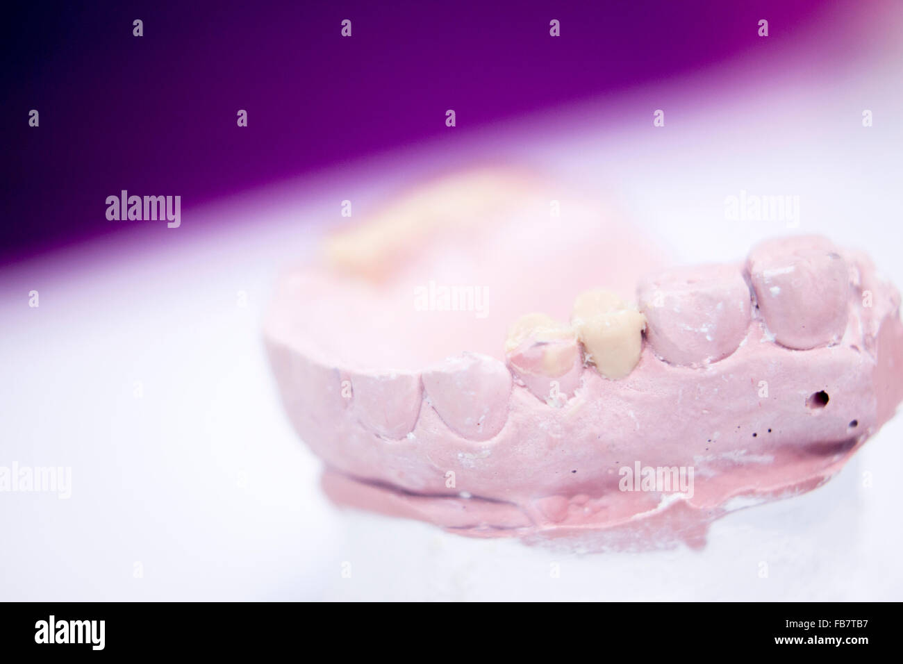 Dental prosthetics clay tooth mold in dentists photo Stock Photo - Alamy