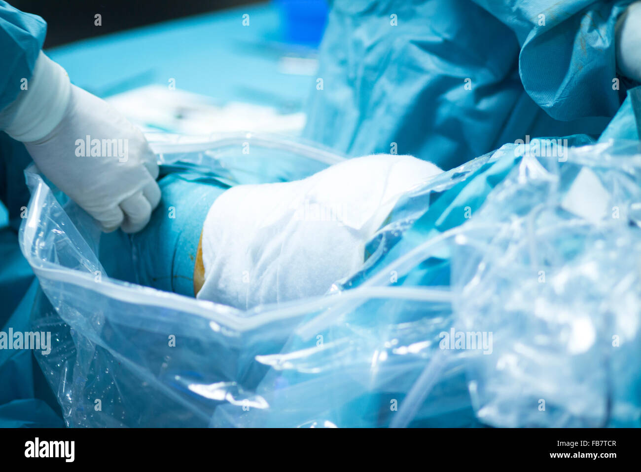 Knee arthroscopy orthopedic surgery operation hi-res stock photography ...