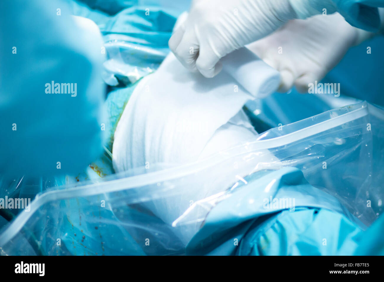 Knee arthroscopy orthopedic surgery operation in hospital emergency ...