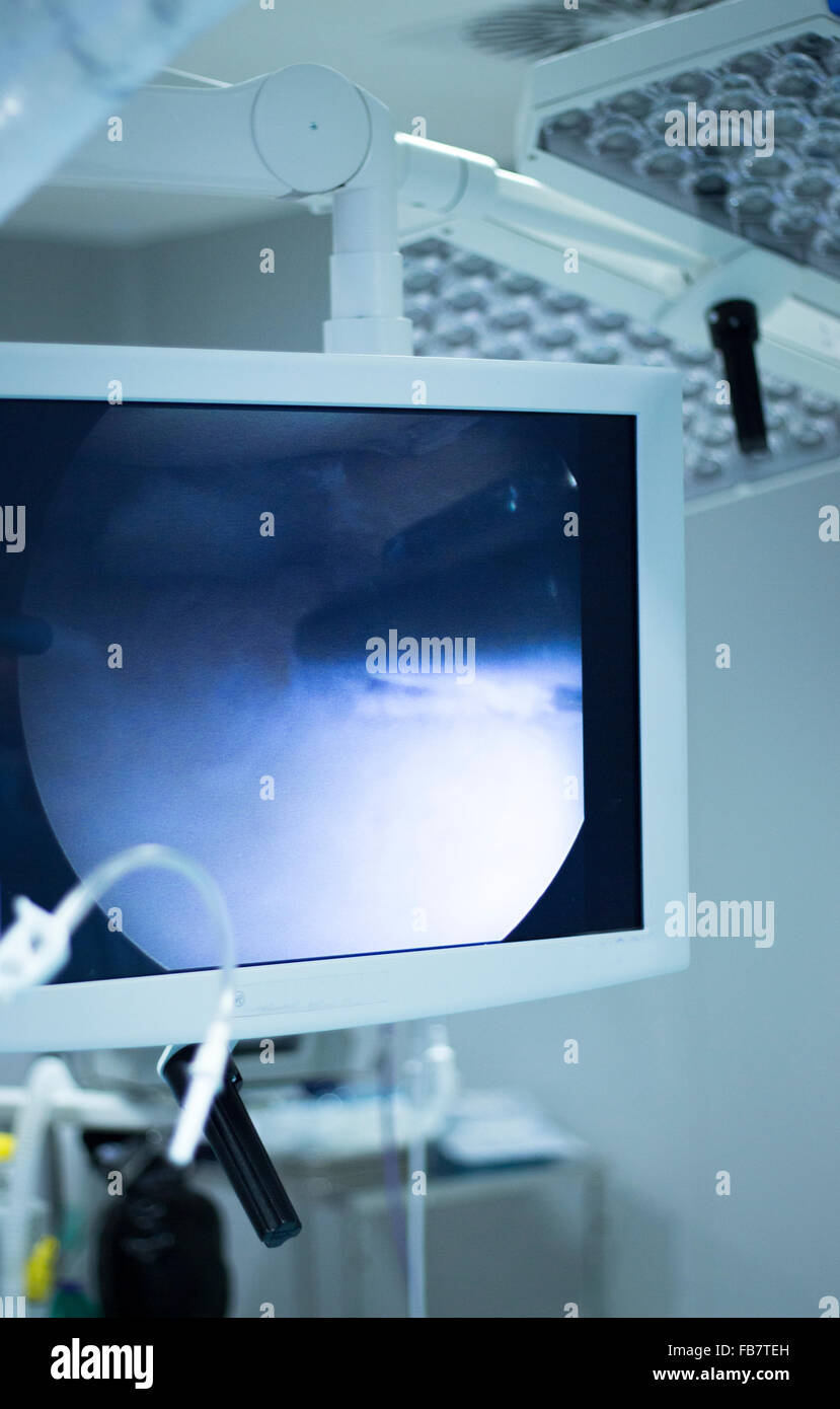 Hospital keyhole micro surgery arthroscopy operation screen showing ...
