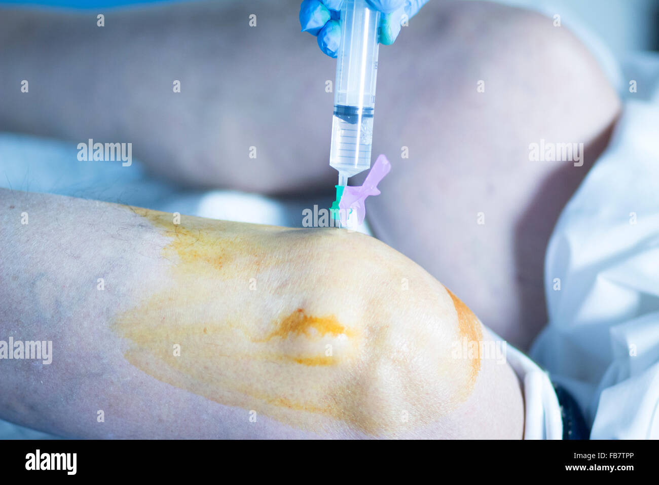 Knee surgery anaesthetic injection during operation in hospital ...