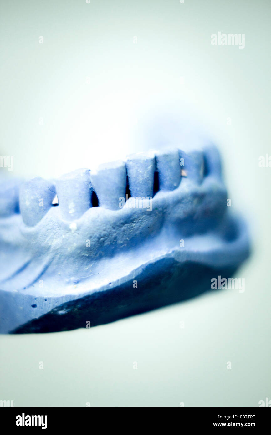 Dental prosthetics clay tooth mold in dentists photo Stock Photo - Alamy