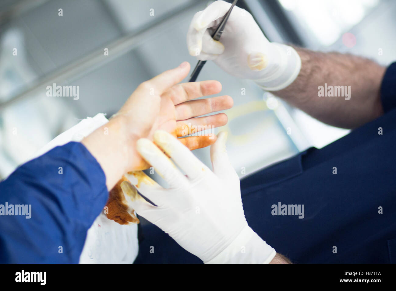 Hospital hand surgery orthopedics operation photo Stock Photo - Alamy