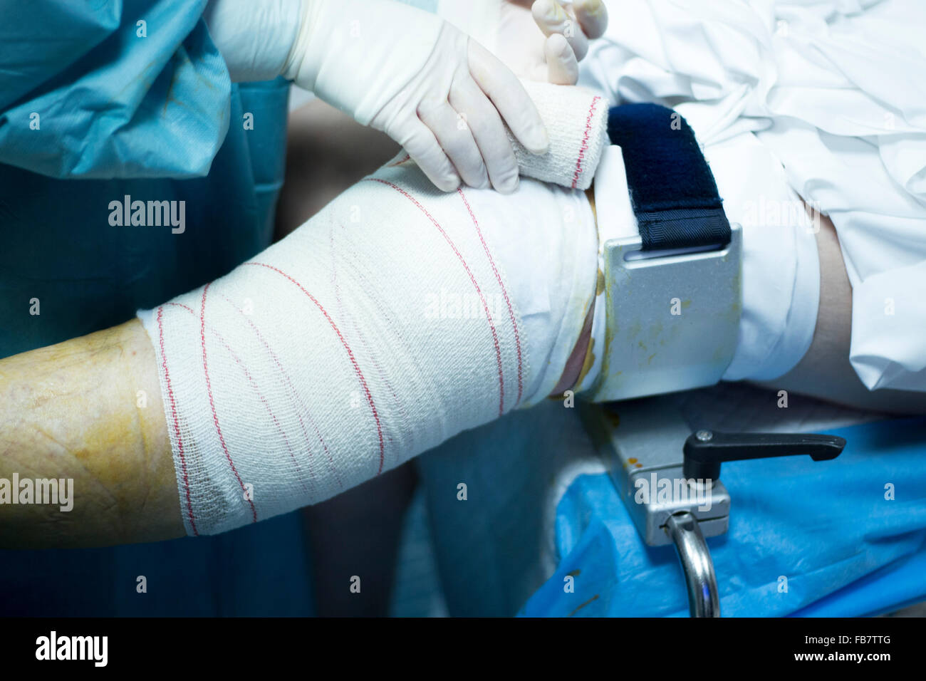 Knee arthroscopy orthopedic surgery operation in hospital emergency ...