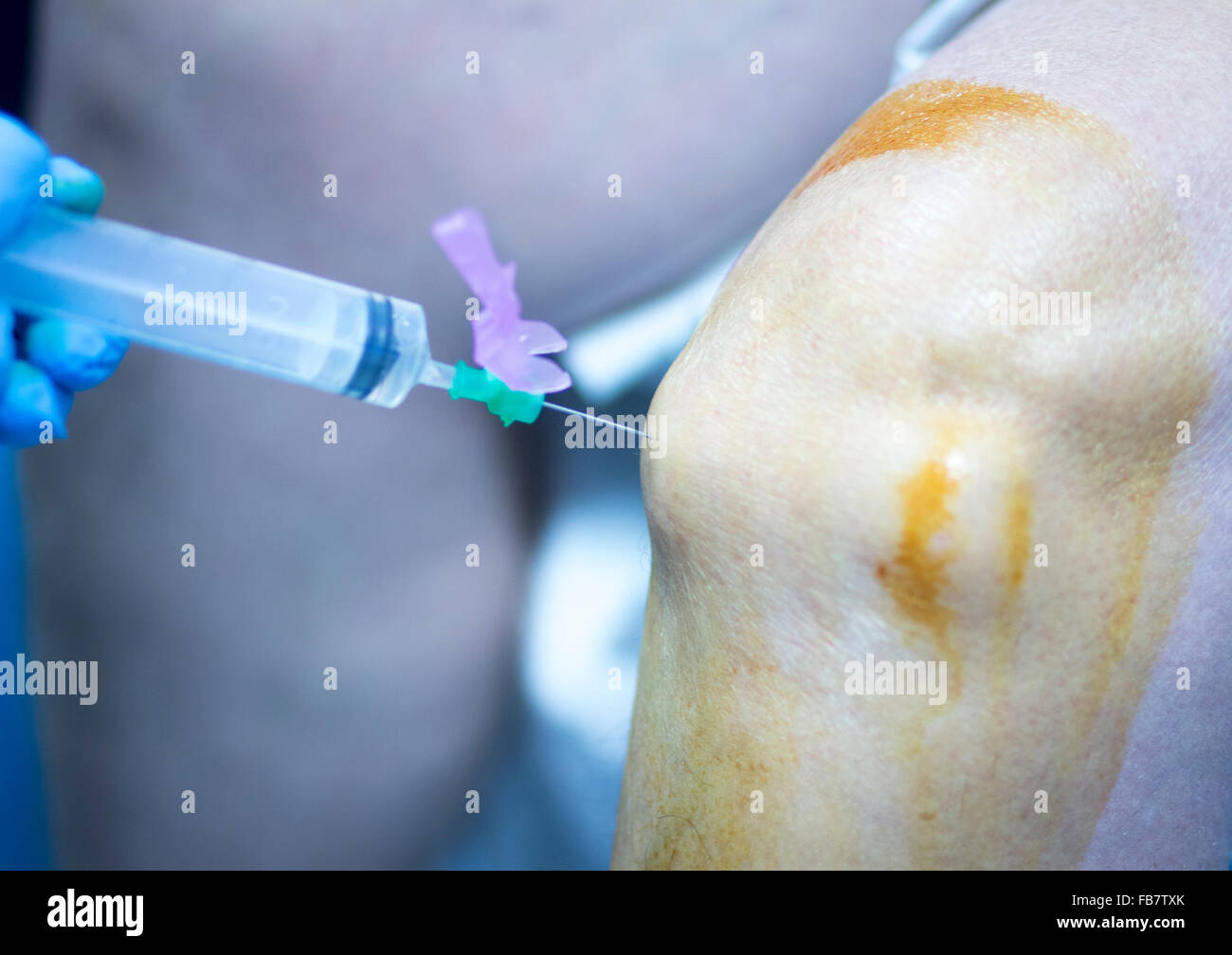Knee surgery anaesthetic injection during operation in hospital ...