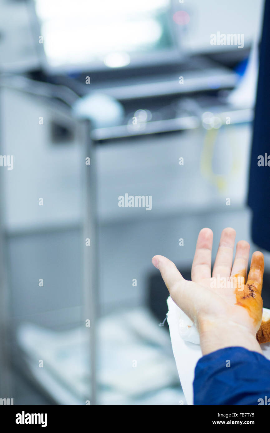 Hospital hand surgery orthopedics operation photo Stock Photo - Alamy