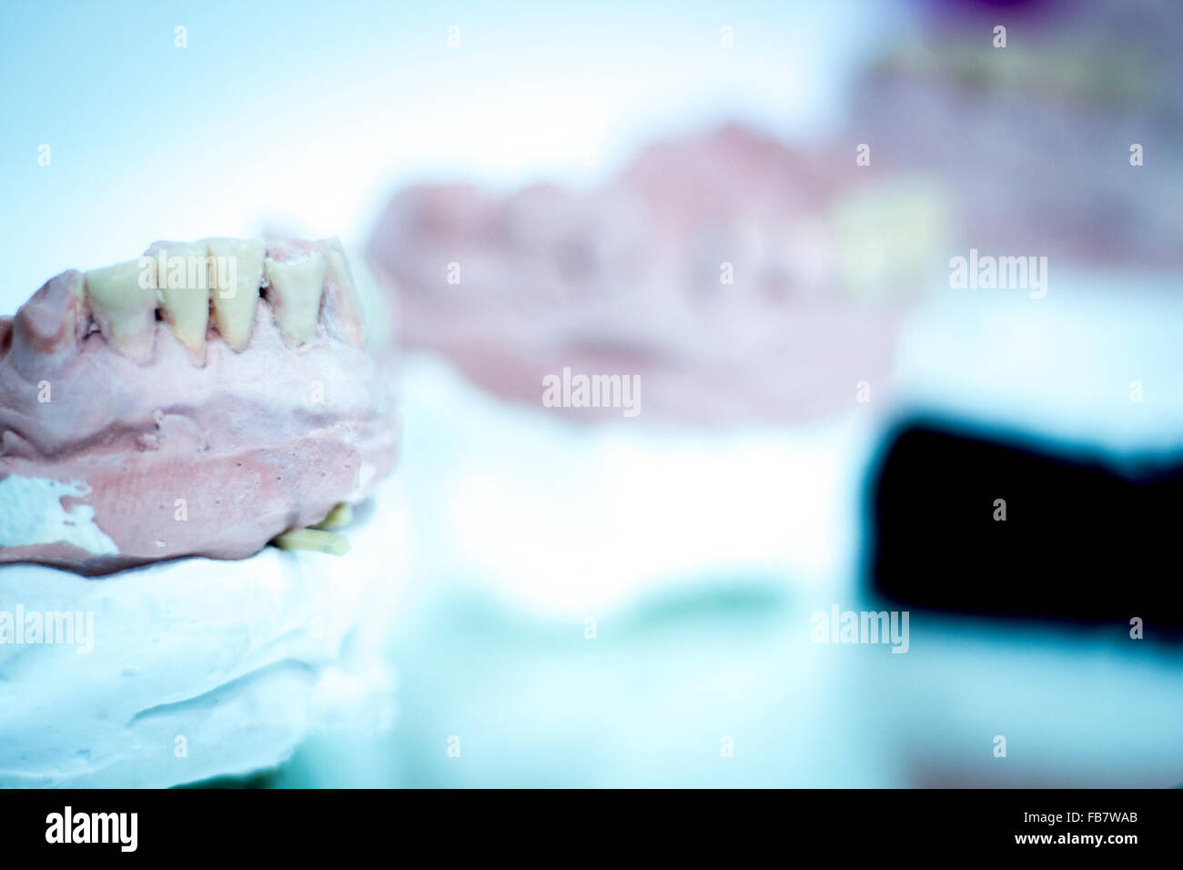 Dental prosthetics clay tooth mold in dentists photo Stock Photo - Alamy