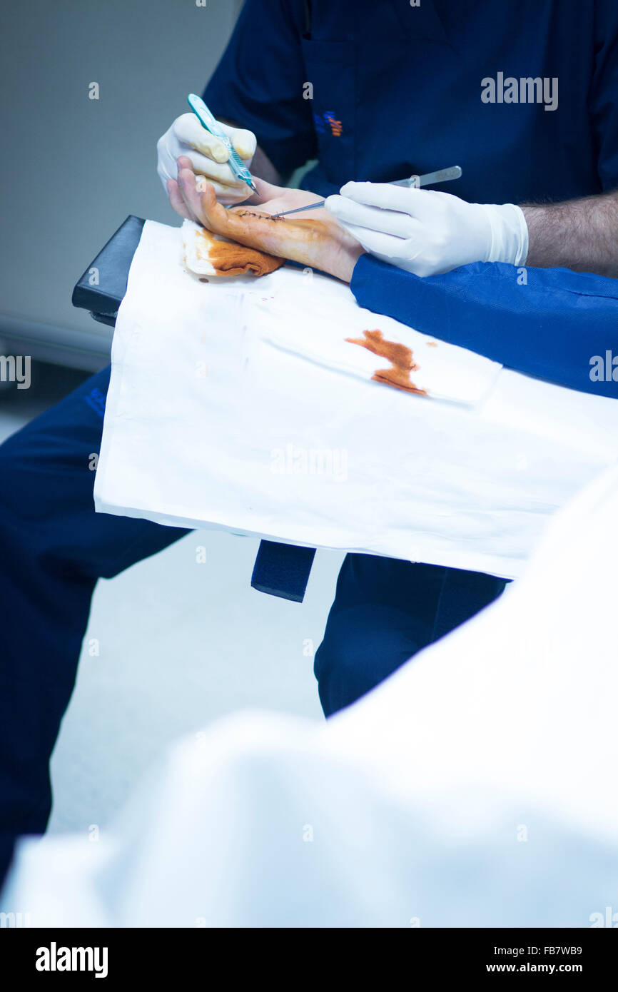 Hospital hand surgery orthopedics operation photo Stock Photo - Alamy