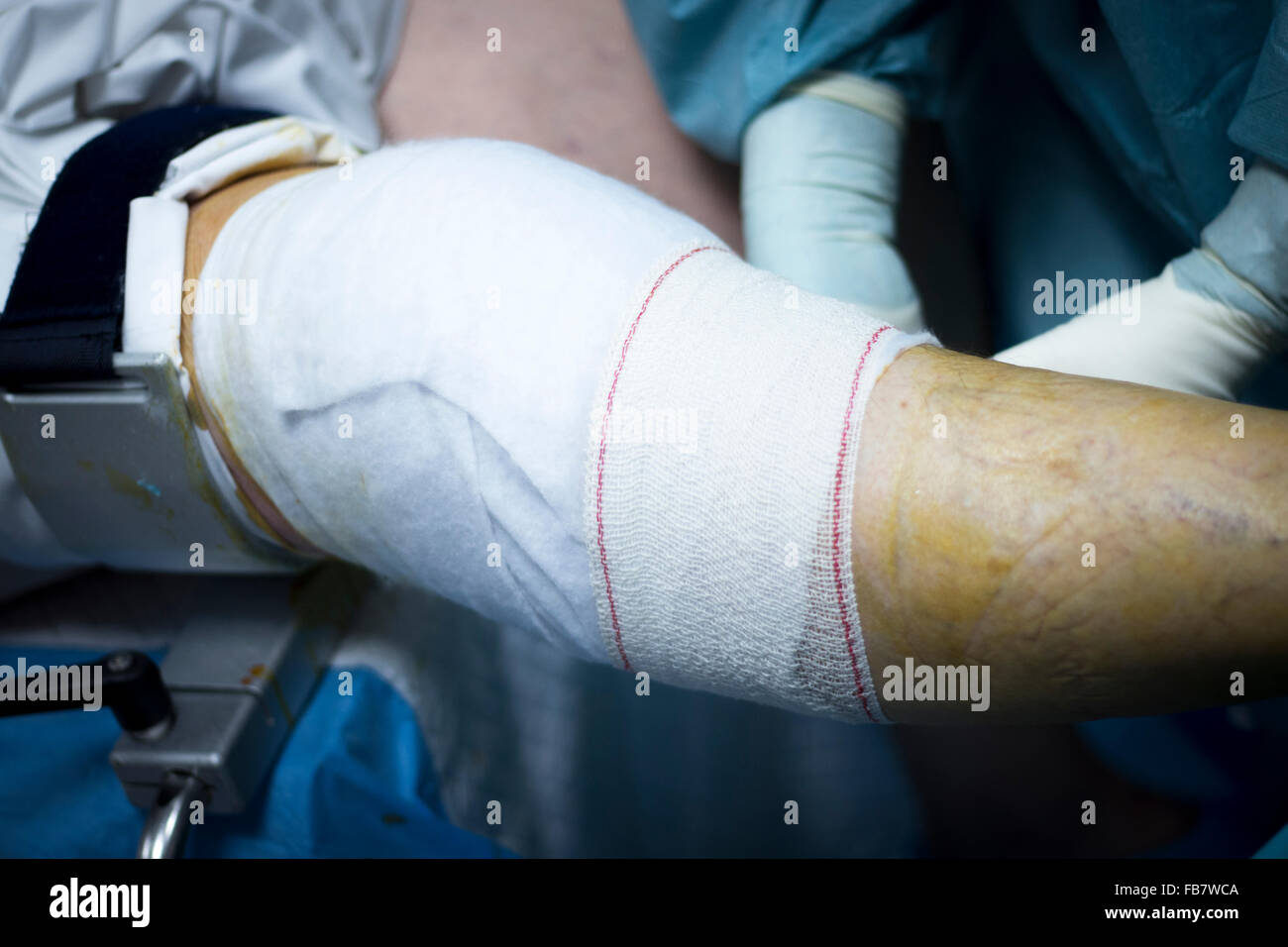 Knee arthroscopy orthopedic surgery operation in hospital emergency ...