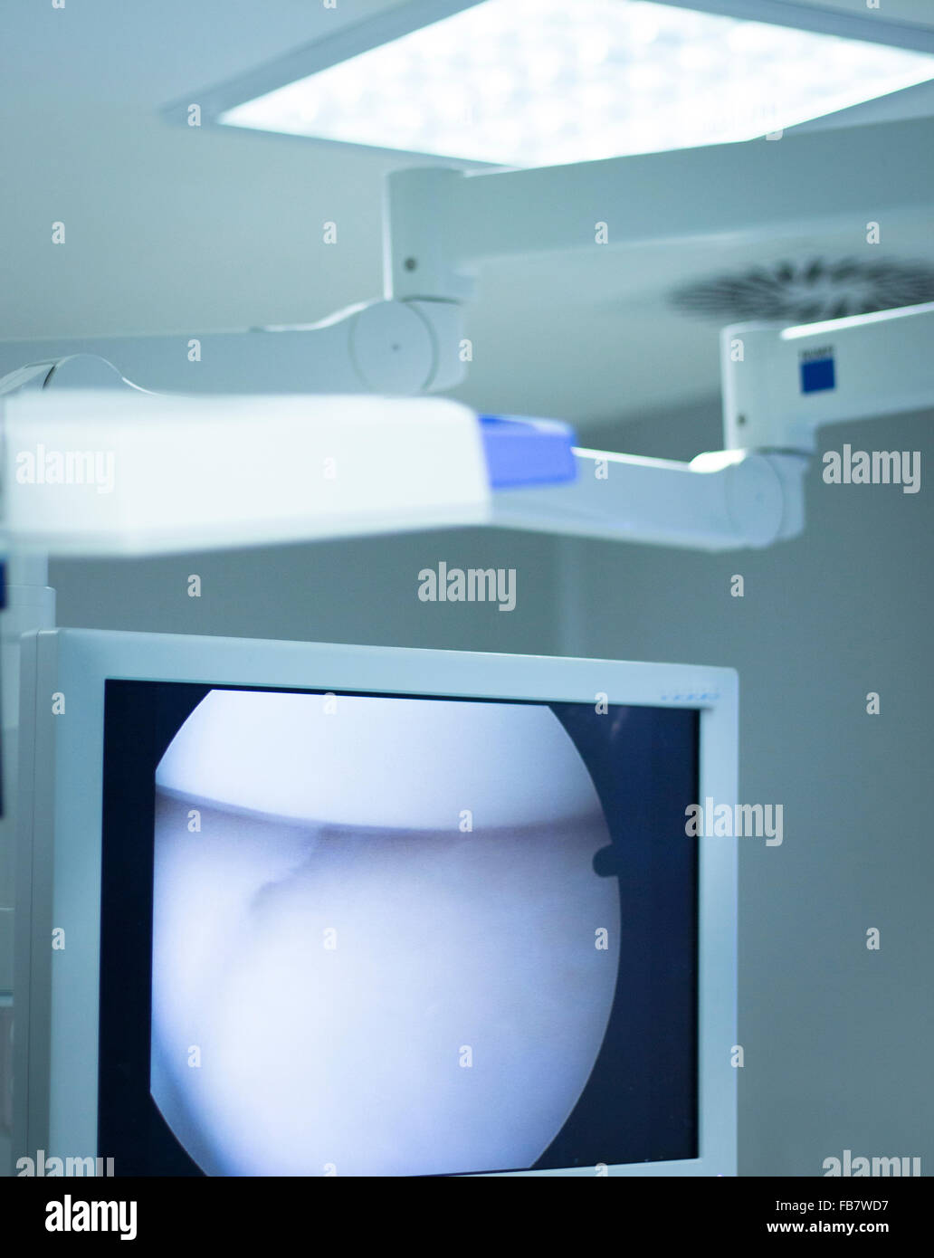 Hospital keyhole micro surgery arthroscopy operation screen showing ...