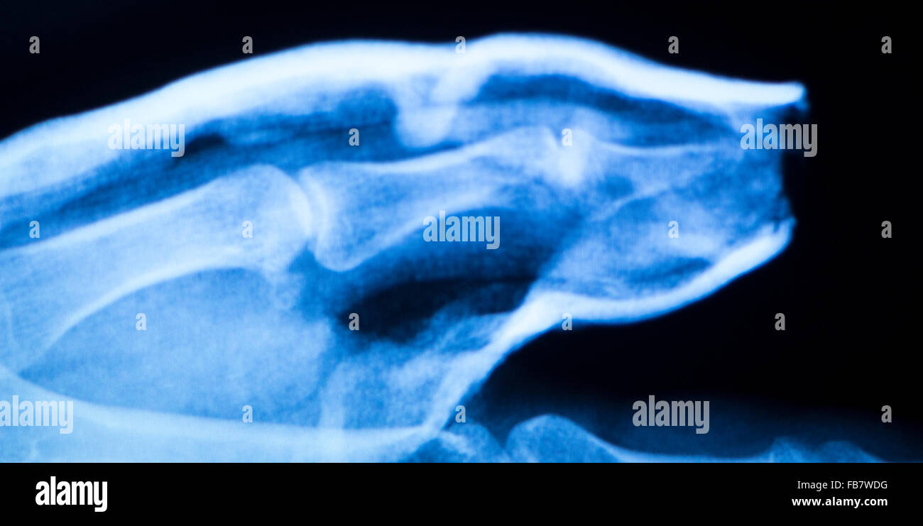 Foot and toes injury x-ray scan orthopedics and Traumatology radiology ...