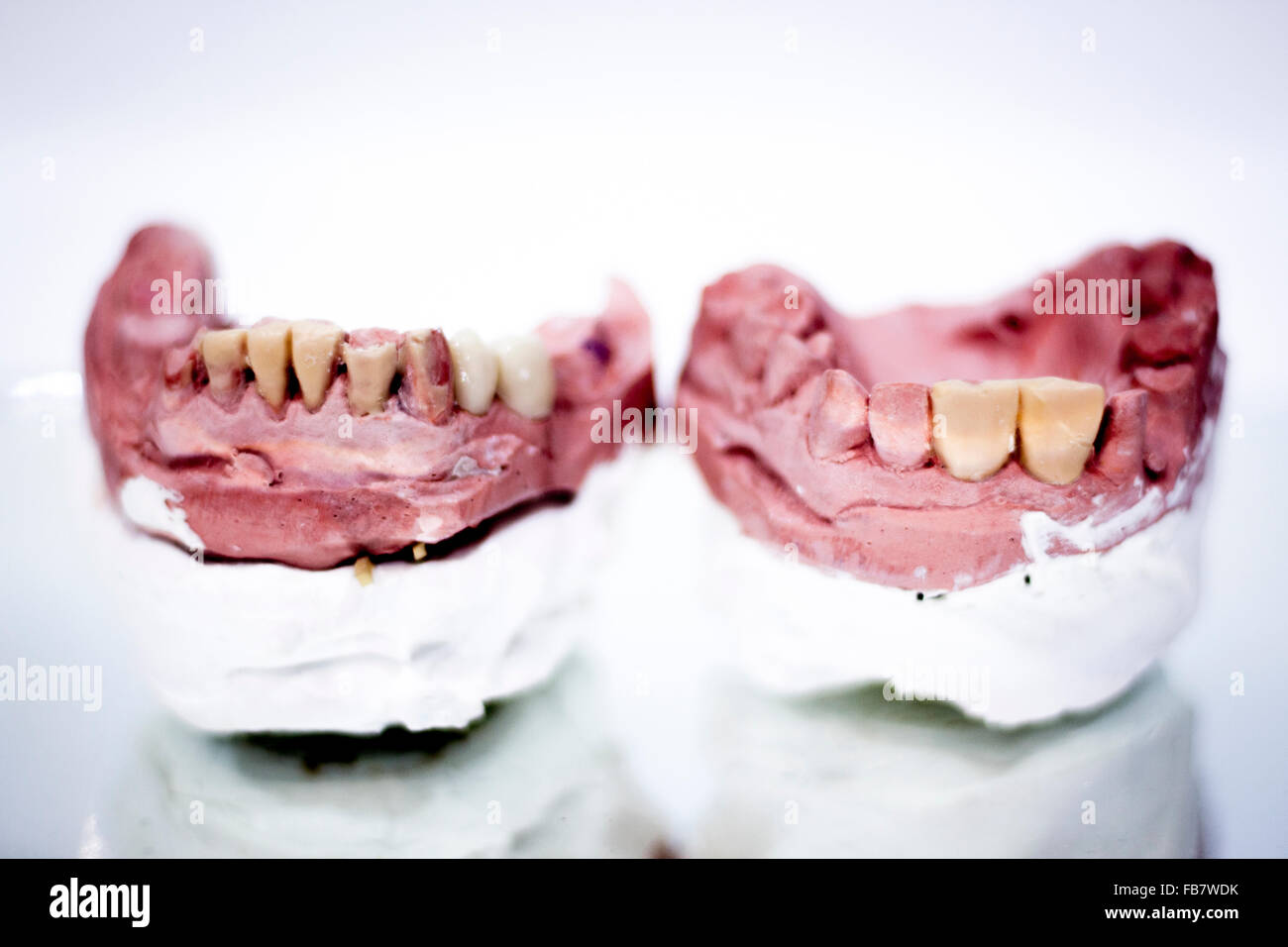 Dental prosthetics clay tooth mold in dentists photo Stock Photo - Alamy