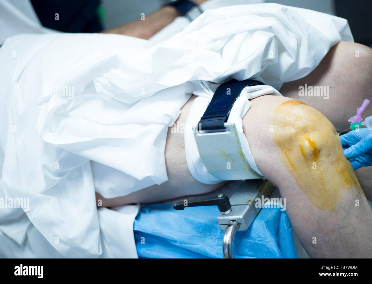 Knee arthroscopy orthopedic surgery operation in hospital emergency ...