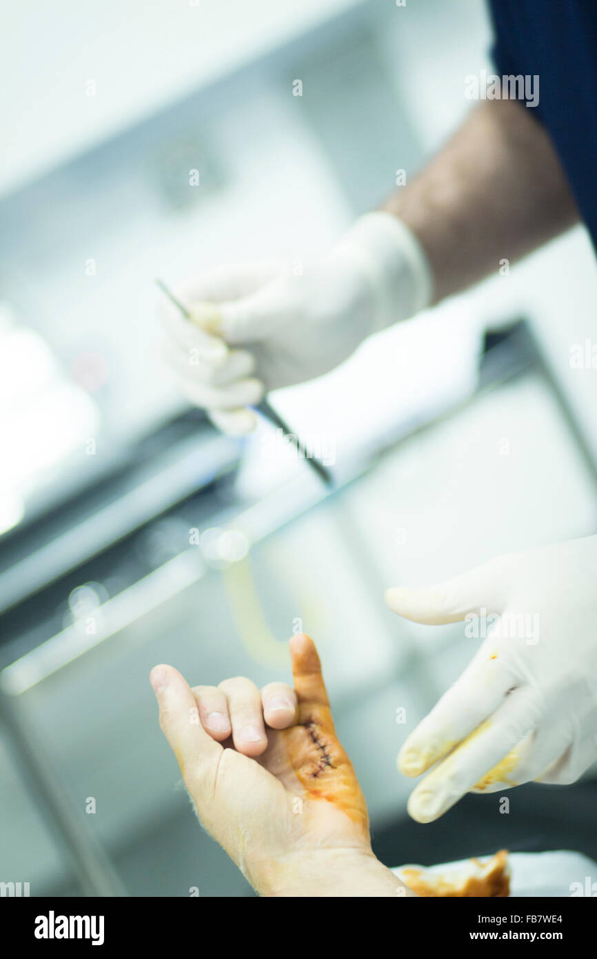 Hospital hand surgery orthopedics operation photo Stock Photo - Alamy