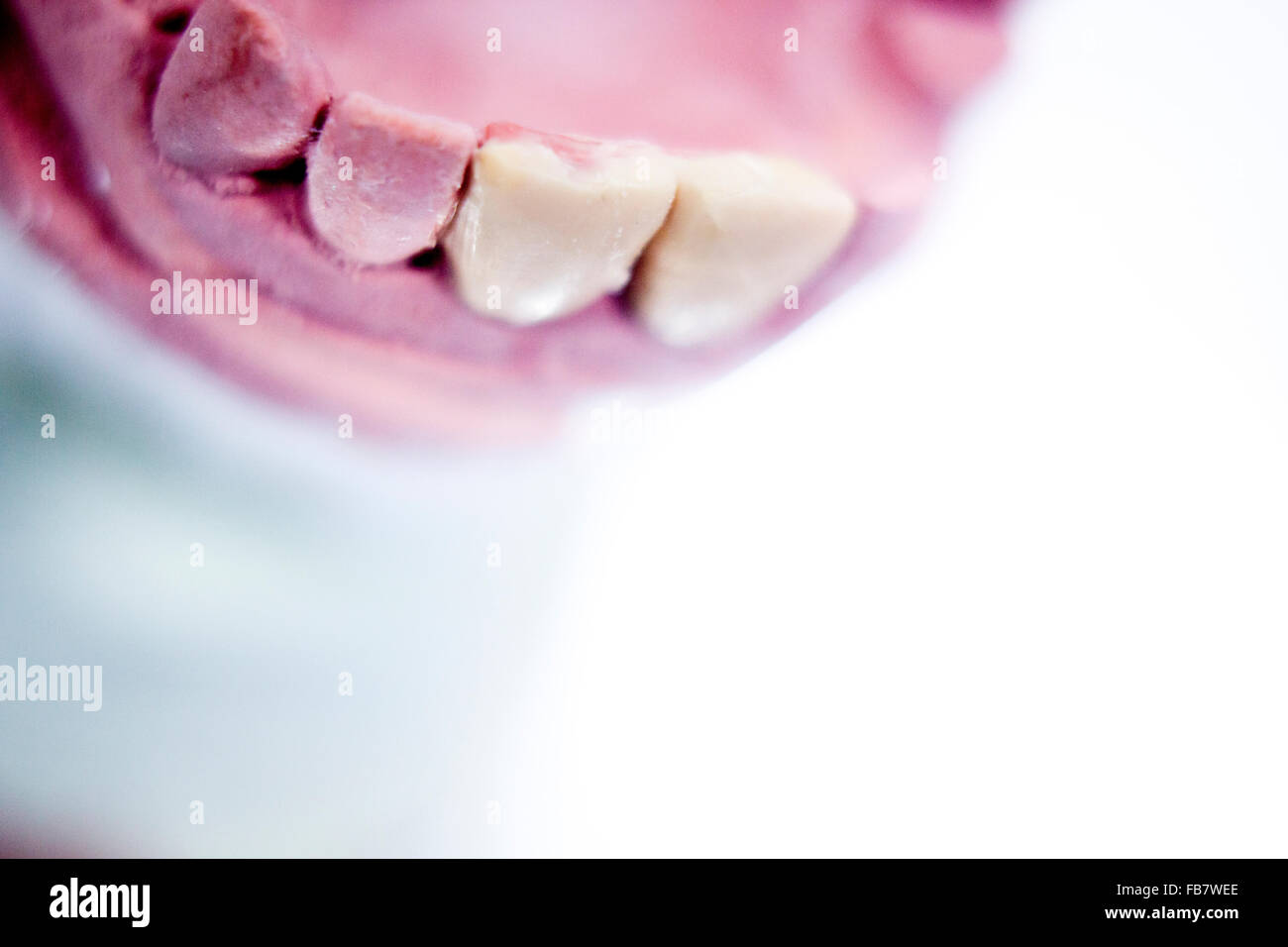 Dental prosthetics clay tooth mold in dentists photo Stock Photo - Alamy