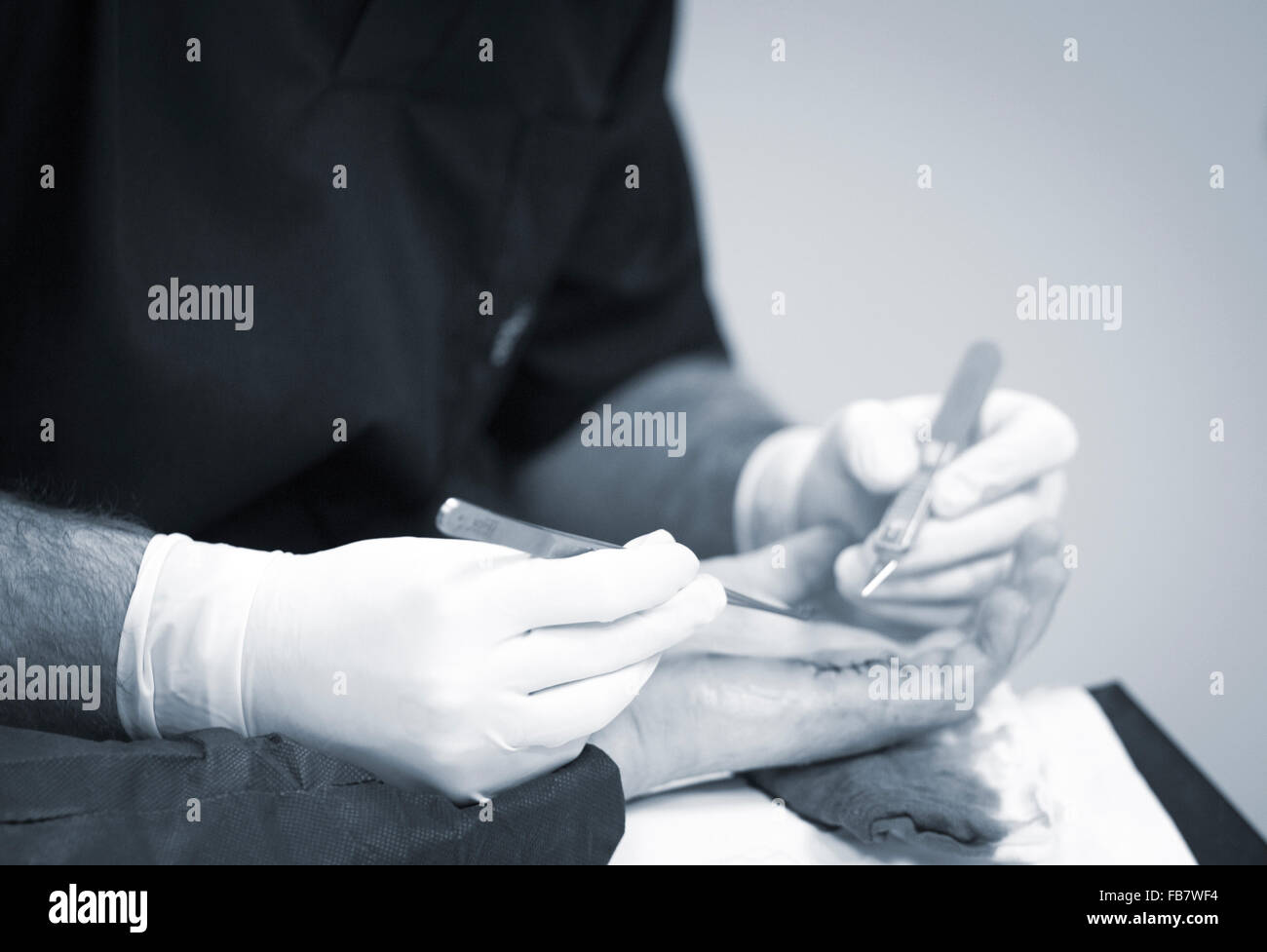 Hospital hand surgery orthopedics operation photo Stock Photo - Alamy