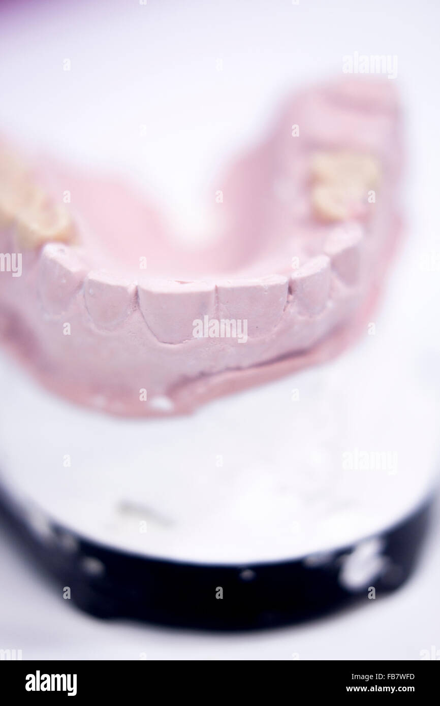 Dental prosthetics clay tooth mold in dentists photo Stock Photo - Alamy