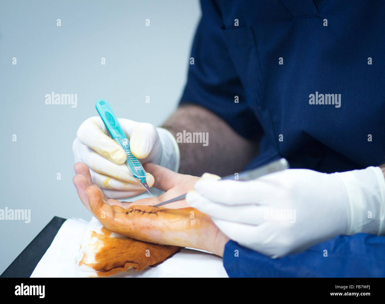Hospital hand surgery orthopedics operation photo Stock Photo - Alamy