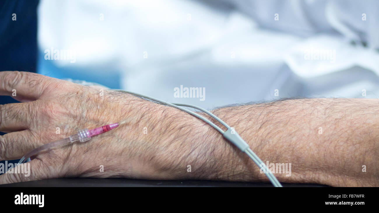 Hand and arm surgery orthopedics operation emergency operating room ...