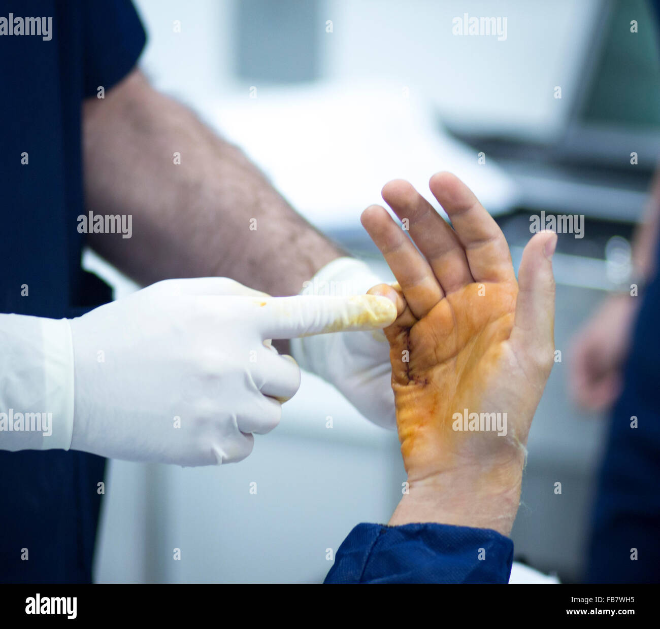 Hospital hand surgery orthopedics operation photo Stock Photo - Alamy