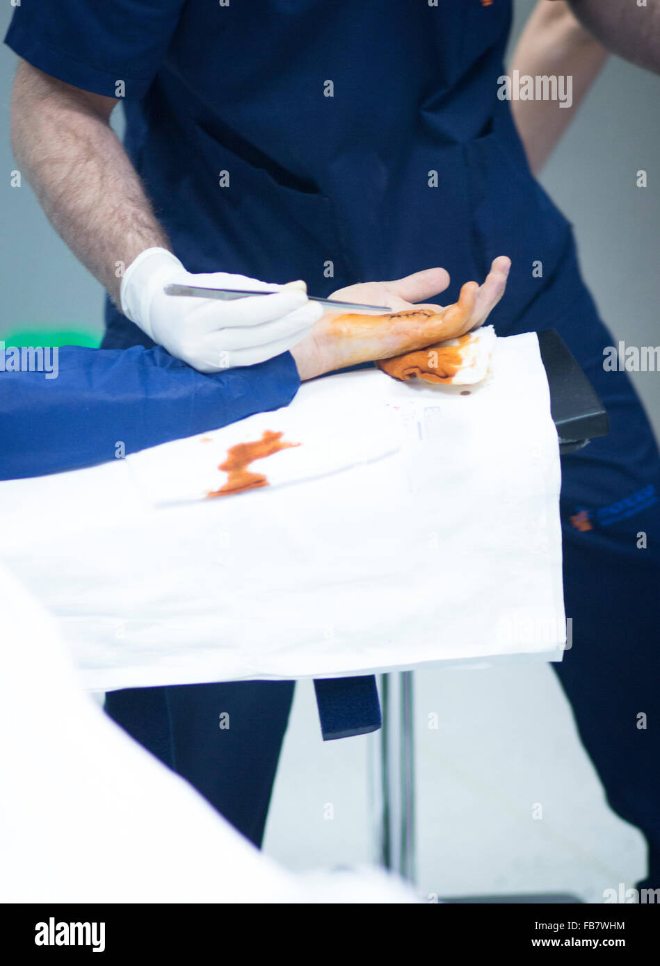 Hospital hand surgery orthopedics operation photo Stock Photo - Alamy