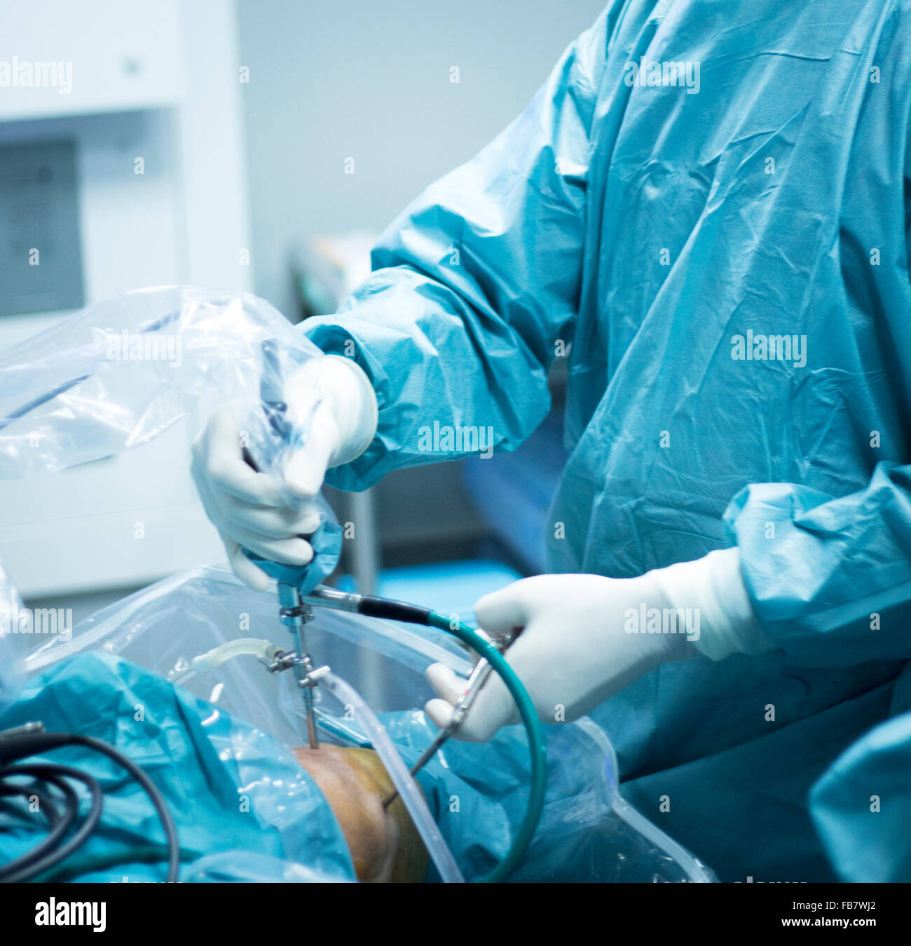 Knee arthroscopy orthopedic surgery operation in hospital operating ...