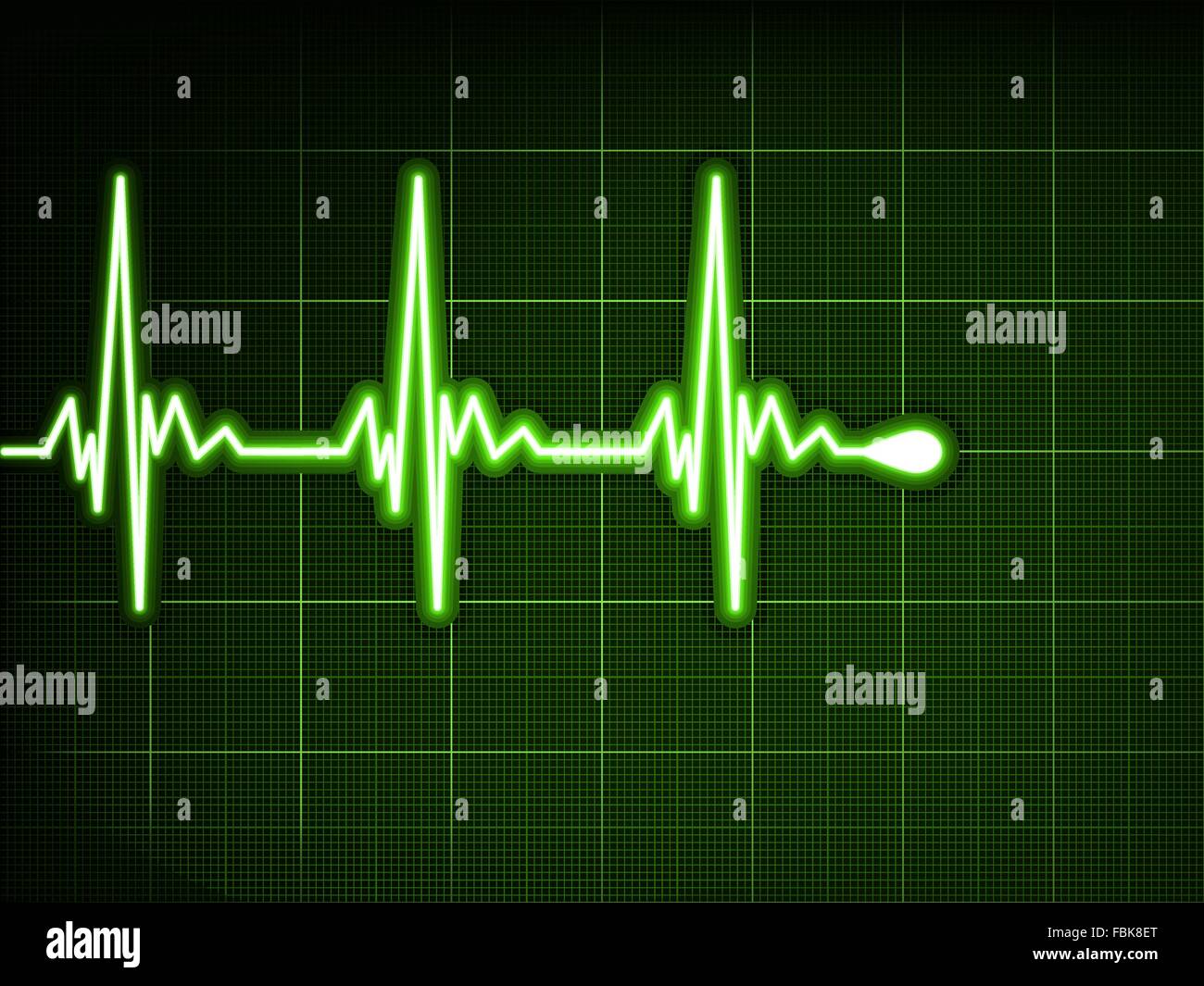 Normal Heart Ekg Stock Vector Images - Alamy