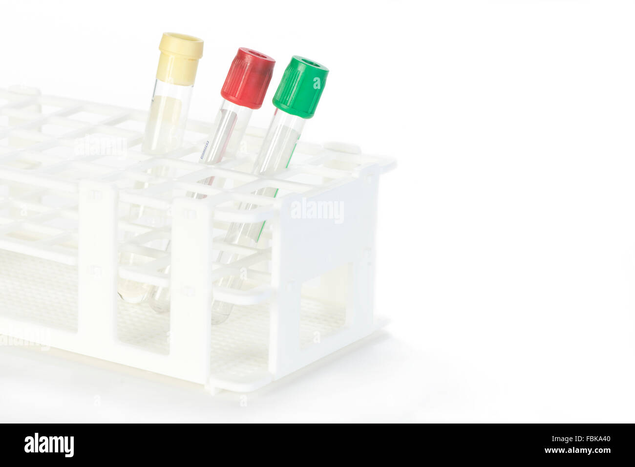 Assorted blood collection tubes in rack with copy space Stock Photo - Alamy