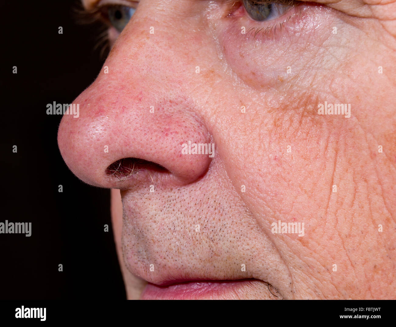 Nose Wrinkle High Resolution Stock Photography and Images - Alamy