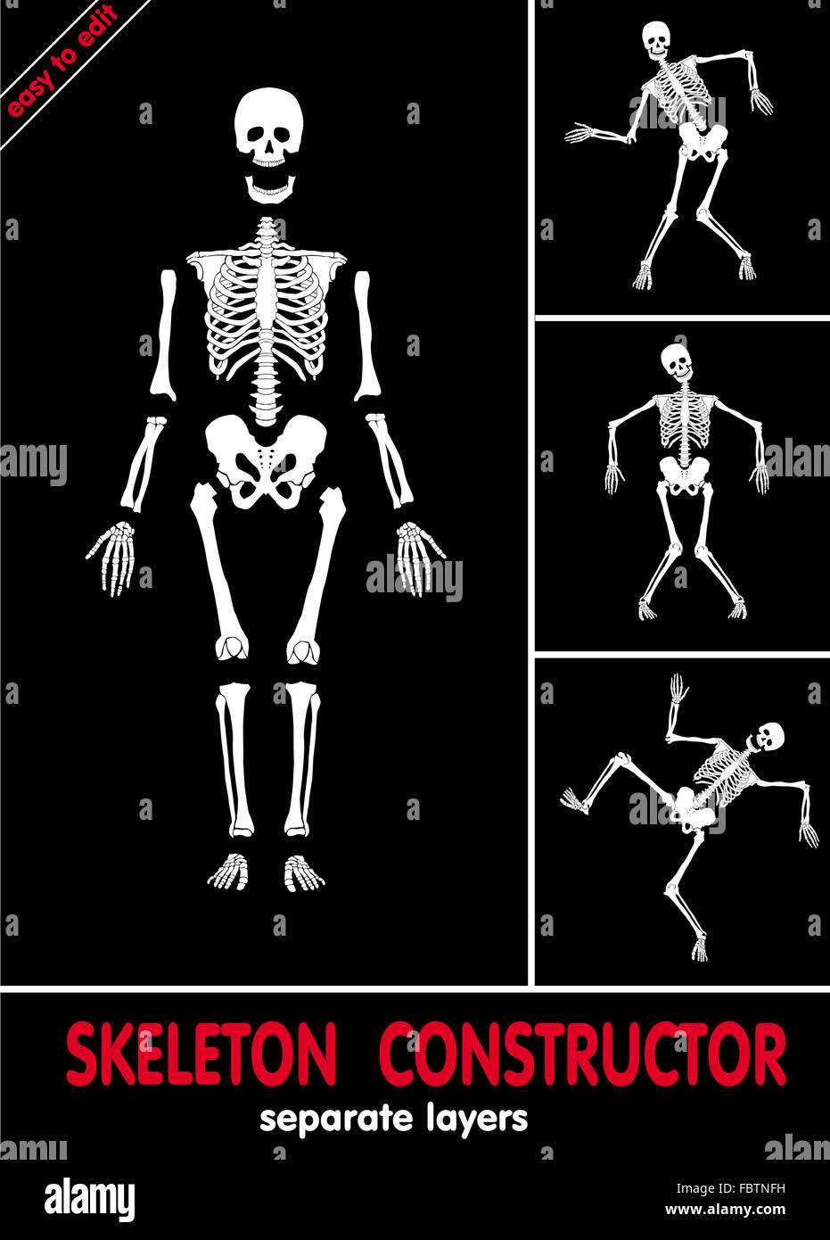 Bone fractures chest hi-res stock photography and images - Alamy